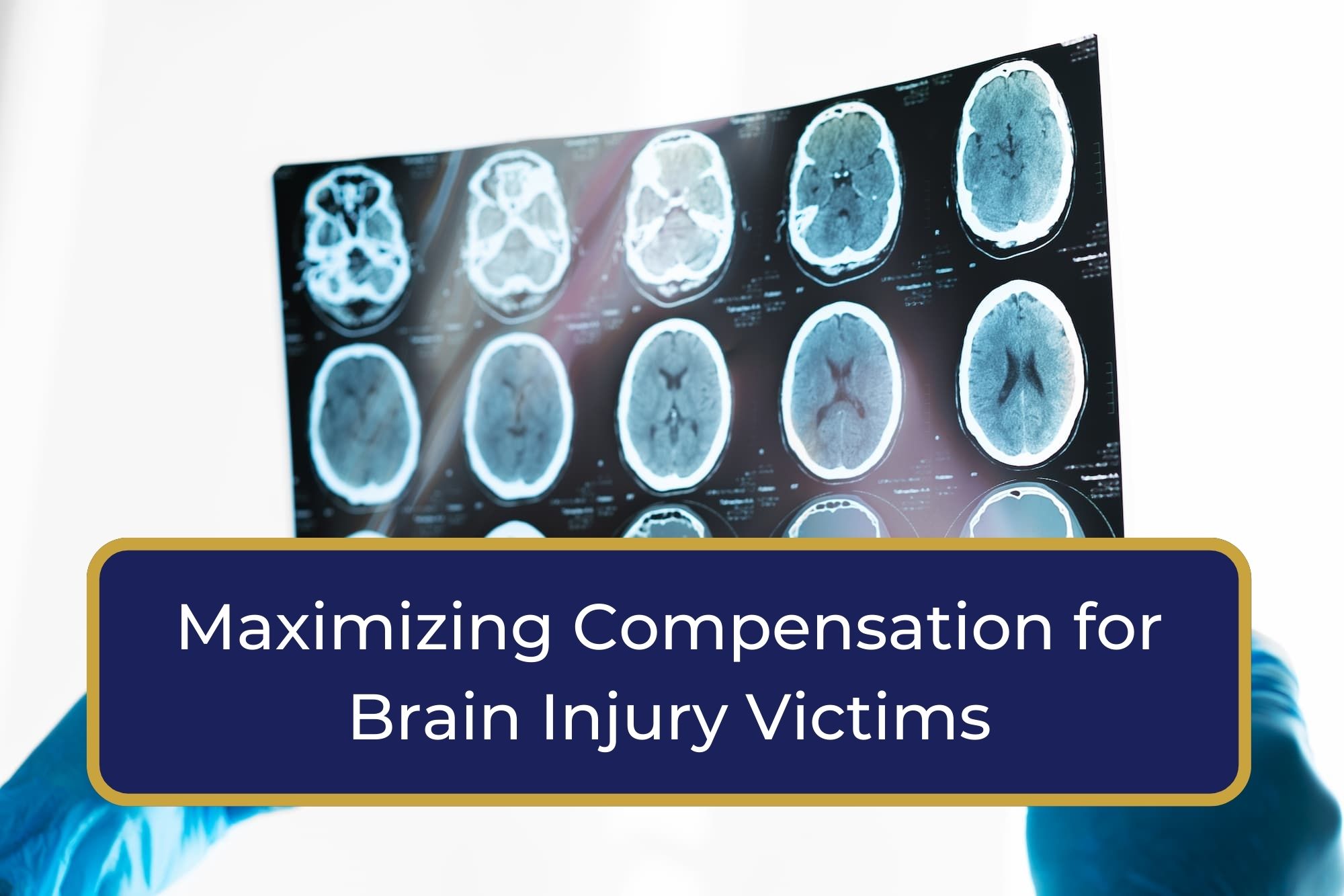 Maximizing Compensation for Brain Injury Victims | AJ Law, PLC